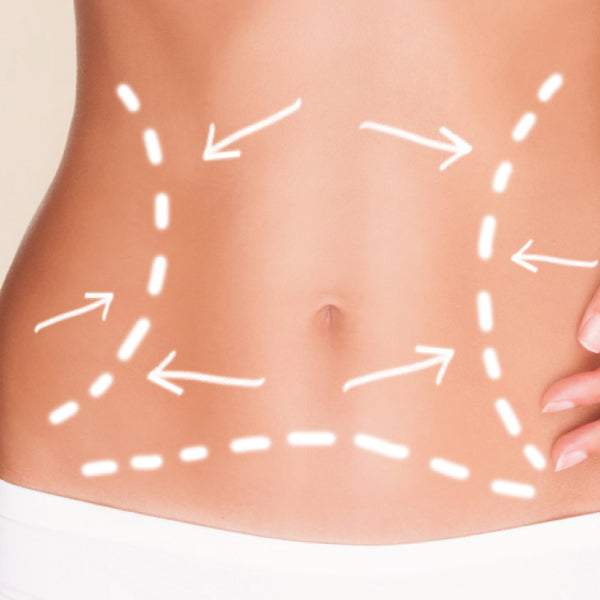 InMode BodyFX – Signature Cosmetic Clinic